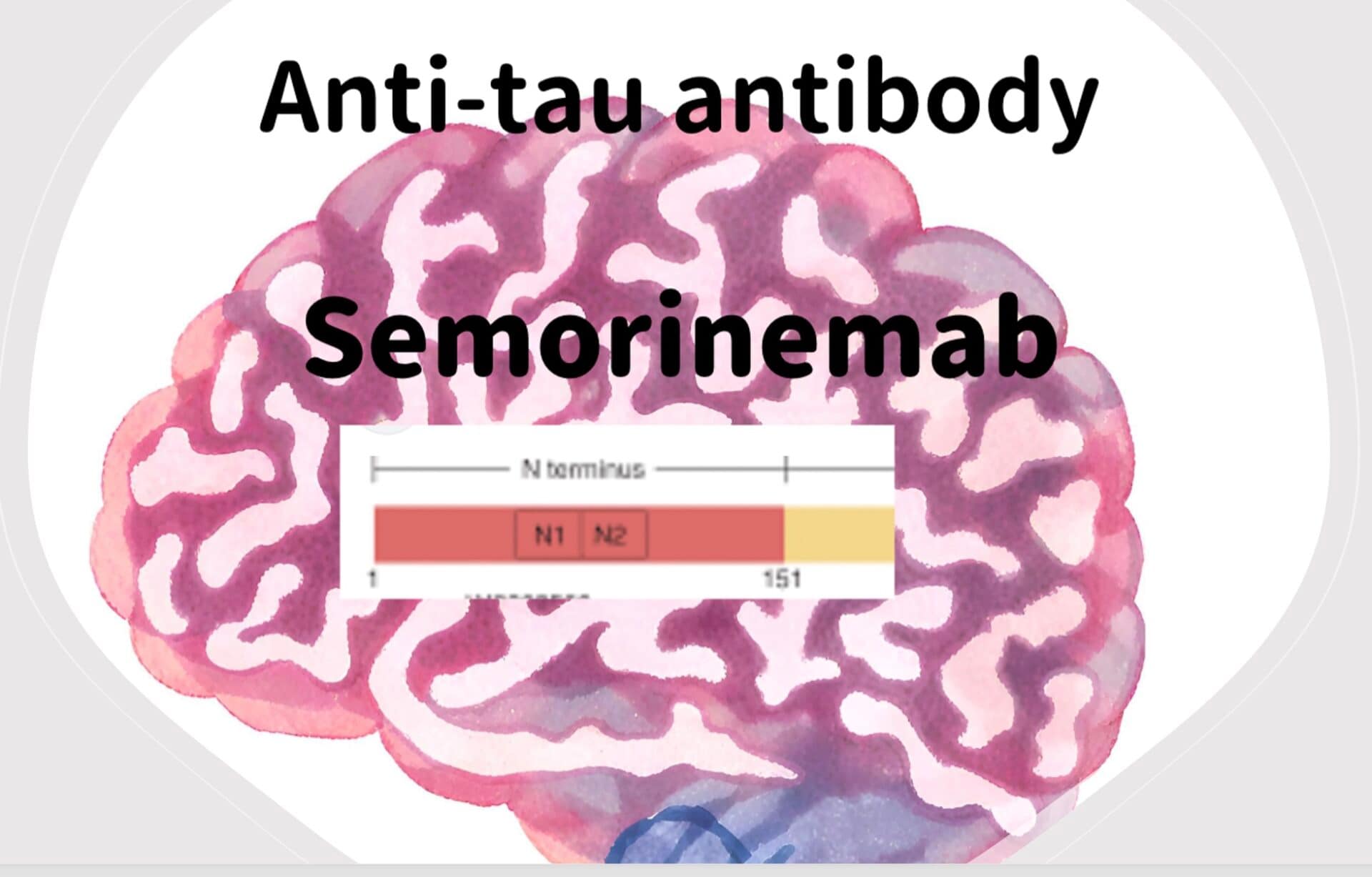 第一個顯示出臨床療效的抗tau蛋白藥物：Semorinemab治療輕至中度阿茲海默失智症的表現和未來展望 - 大腦森林閱讀之旅